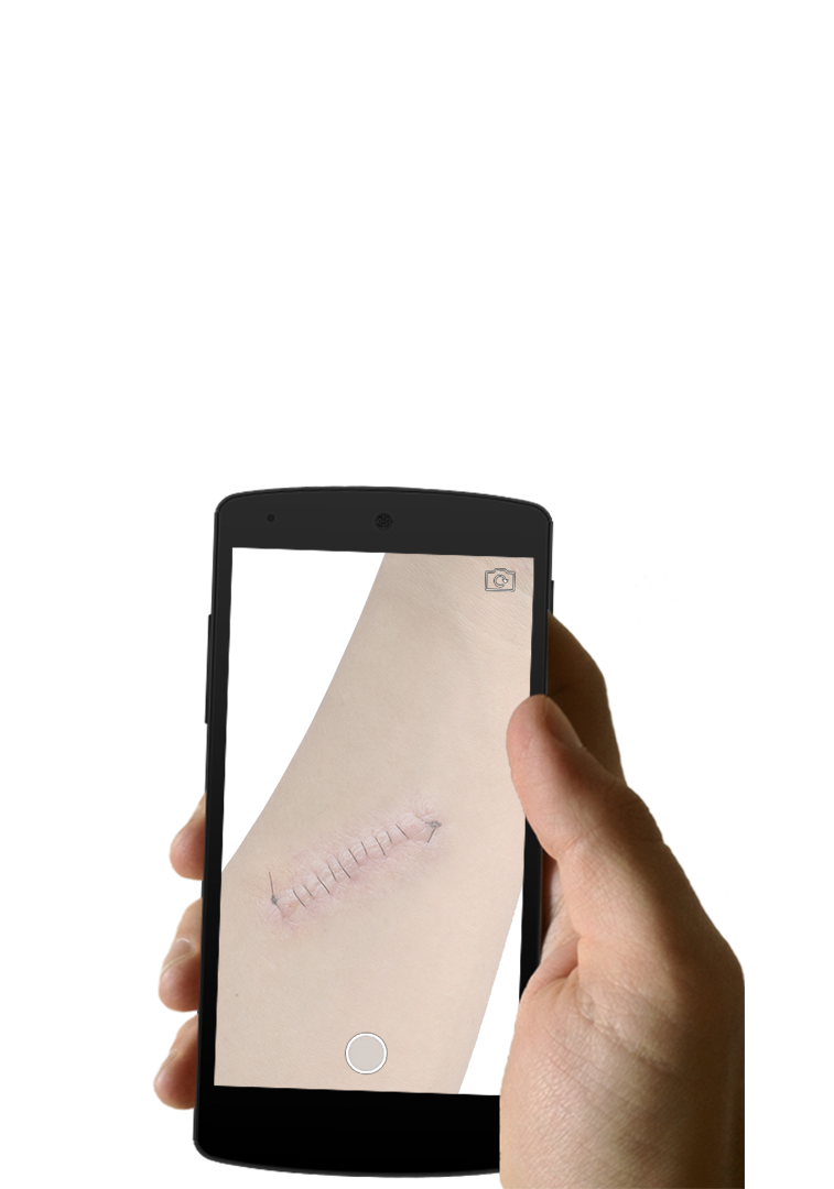 Parable - The New Standard for Wound Care